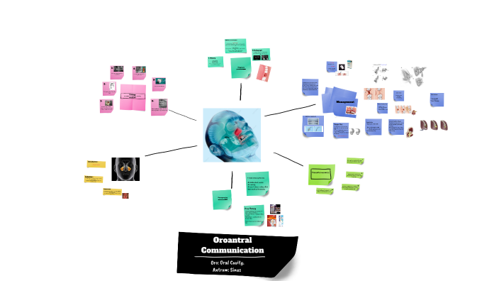 Oroantral Communication by رحيق الورد on Prezi
