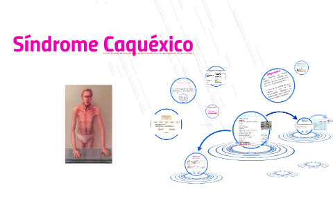Sindrome caquexico by gabriela villalobos on Prezi
