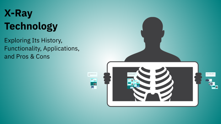 X-Ray Technology by abdo ragab on Prezi