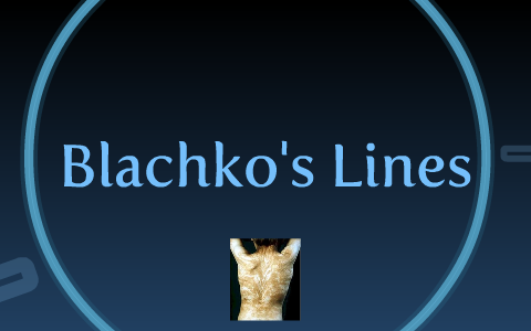 Blaschko's Lines by corah holler on Prezi