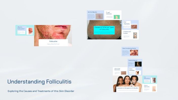 Understanding Folliculitis by Kamryn Oliver _ Student - CaryHS on Prezi