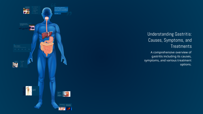 Understanding Gastritis: Causes, Symptoms, and Treatments by Mandeeq ...