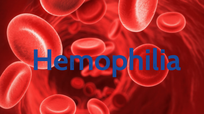 hemophilia is caused by a genetic mutation. The mutations in by Bryce Dirks