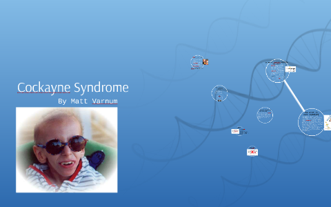 Cockayne Syndrom by Matthew Varnum