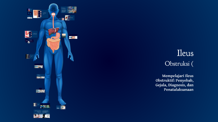 PPT tentang Ileus Obstruksi Referat by Irgi Rahmaddani on Prezi