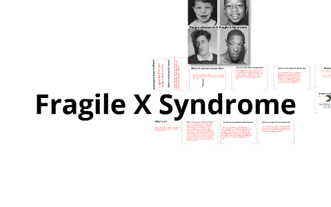 Fragile X Syndrome by Jeremy Smith on Prezi
