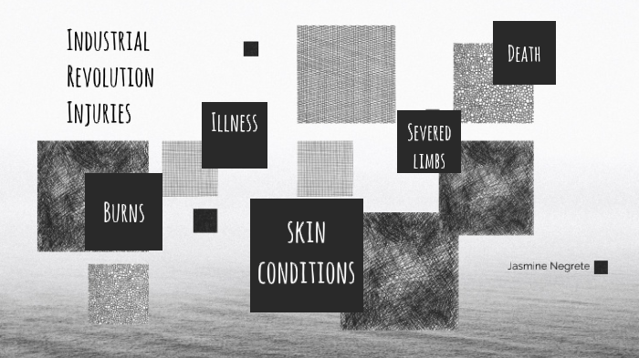 Industrial Revolution injuries by Jasmine Negrete on Prezi