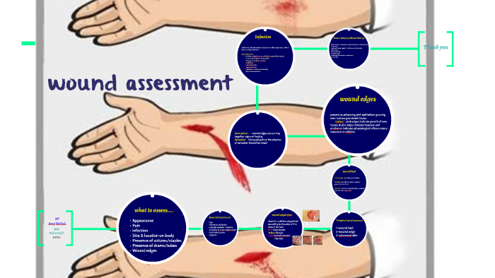 Wound Assessment By Areej Bakhsh wound-assessment-by-areej-bakhsh