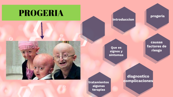 progeria by krisley valdes on Prezi