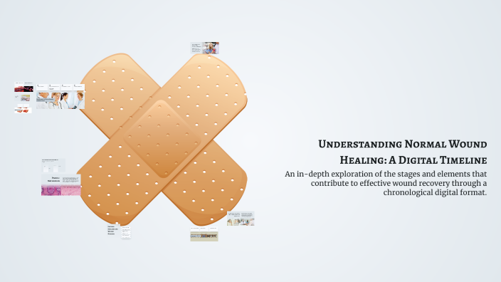 Understanding Normal Wound Healing: A Digital Timeline by Alex Gergen ...