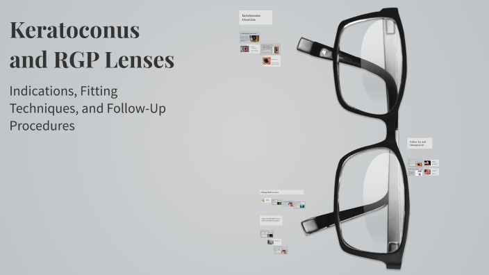 Keratoconus and RGP Lenses by Beenish Latif on Prezi