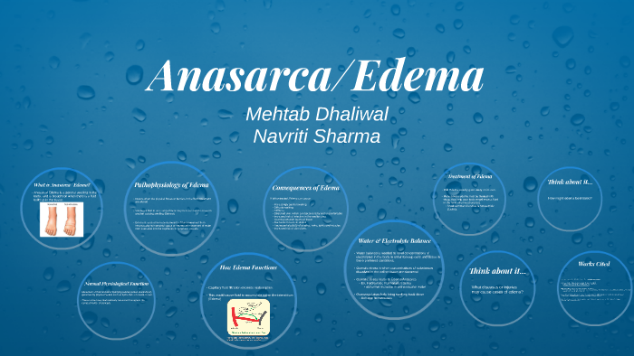 Anasarca/Edema by Mehtab Dhaliwal on Prezi