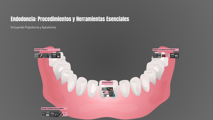 Endodoncia: Procedimientos y Herramientas Esenciales by José Ángel ...