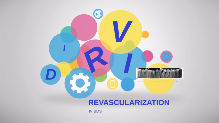 Revascularization by yohan chacko on Prezi