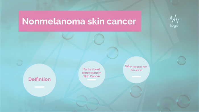 Non-melanoma by Kayla Seidel on Prezi