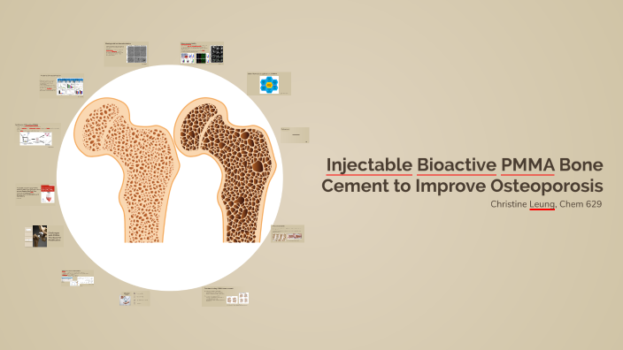 Injectable Bioactive PMMA Bone Cement to Improve Osteogenesis by ...