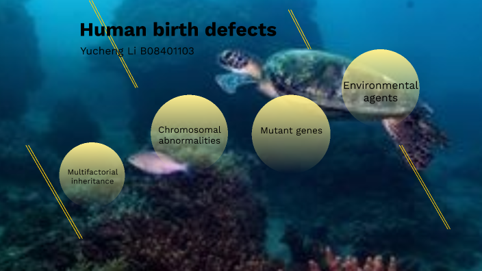 Human birth defects b08401103 by 李昱澄 on Prezi