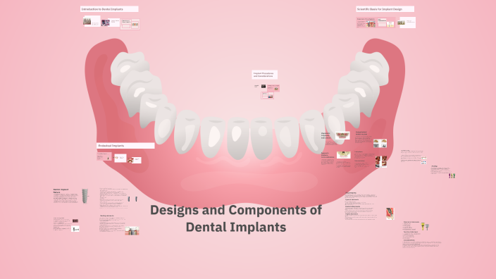 Designs and Components of Dental Implants by Amir Fawzy on Prezi