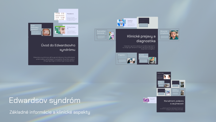 Edwardsov syndróm by Lenka Janigová on Prezi