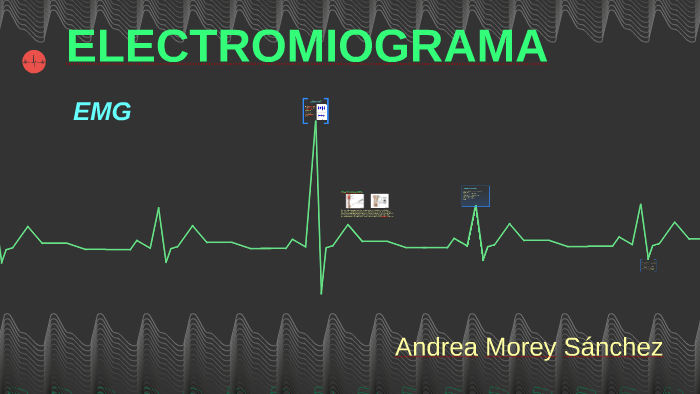 ELECTROMIOGRAMA by Andrea Morey Sánchez on Prezi