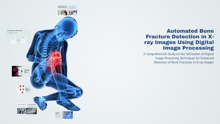 Automated Bone Fracture Detection in X-ray Images Using Digital Image ...