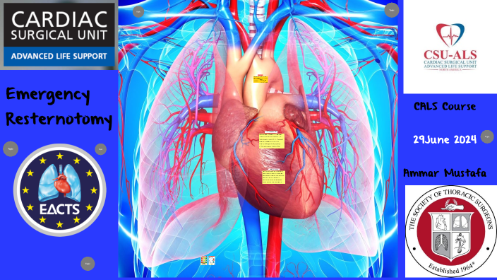 Emergency Resternotomy by Ammar Mustafa on Prezi