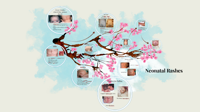 Neonatal Rashes by Brianne Mullarkey