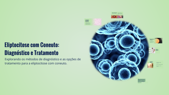 Eliptocitose com Coneuto: Diagnóstico e Tratamento by Gabriela ...