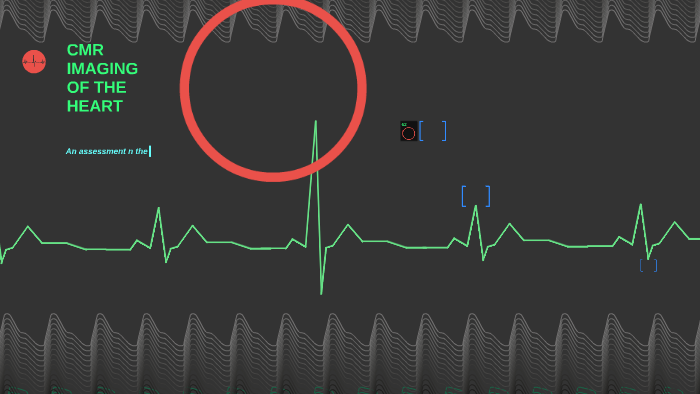 CMR IMAGING OF THE HEART by