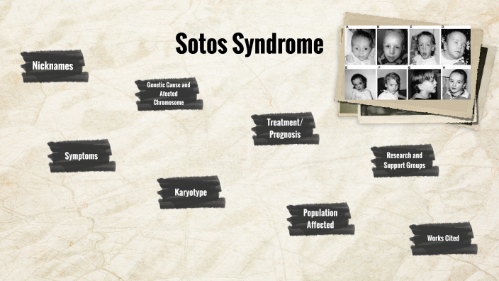 Sotos Syndrome by Estephanie Valenzuela on Prezi