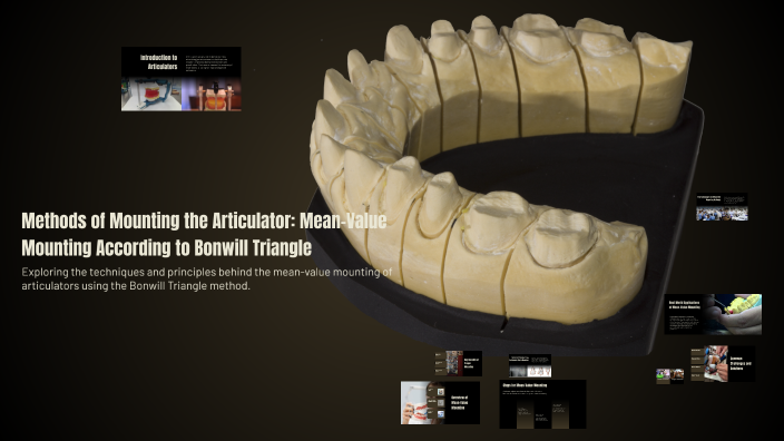 Methods of Mounting the Articulator: Mean-Value Mounting According to ...