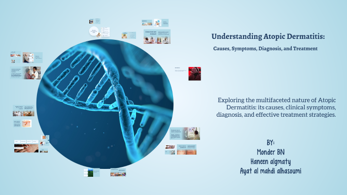 Understanding Atopic Dermatitis: Causes, Symptoms, Diagnosis, and ...