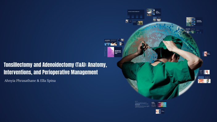 Tonsillectomy and Adenoidectomy (T&A): Anatomy, Interventions, and ...