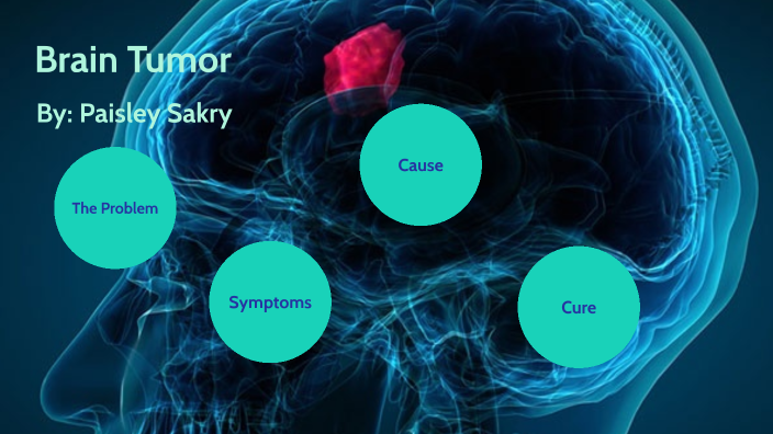 Brain tumor by: Paisley Sakry by Student Paisley Sakry on Prezi