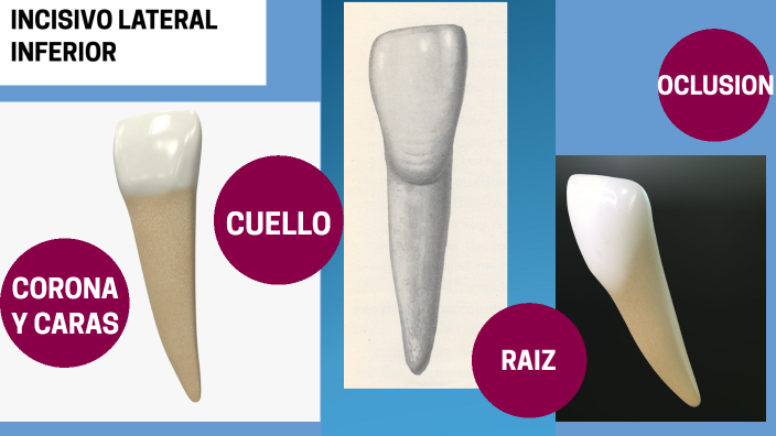 INCISIVO LATERAL INFERIOR by Erick Gómez on Prezi