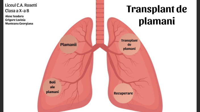 transplant de plămâni by Teodora Alexe on Prezi