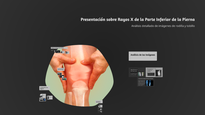 Presentación sobre Rayos X de la Parte Inferior de la Pierna by laura ...