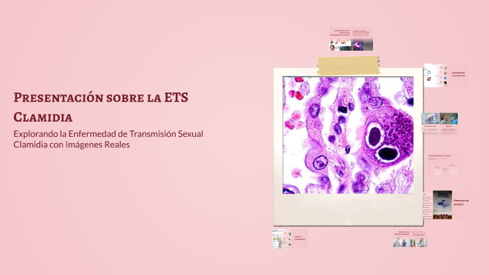 Presentación sobre la ETS Clamidia by Jusseth Urbina on Prezi