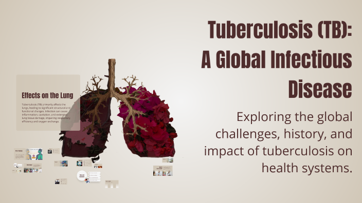 Tuberculosis (TB): A Global Infectious Disease by BISMA ZAHID on Prezi