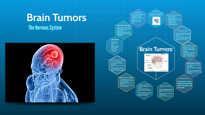 Brain Tumors by Mark Salama on Prezi