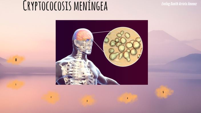 Cryptococosis Meníngea by Eveling Arrieta on Prezi