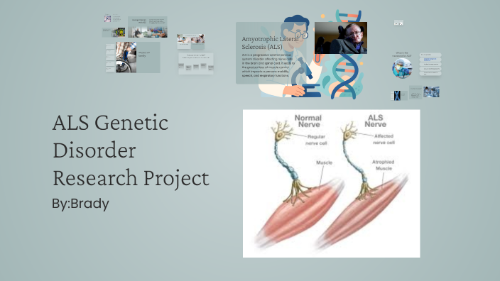ALS Genetic Disorder Research Project by Brady Prosch on Prezi