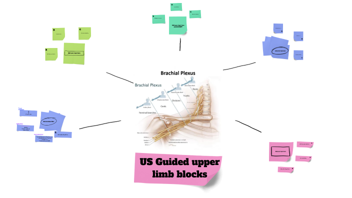 US Guided upper limb blocks by Marwa Rashed on Prezi