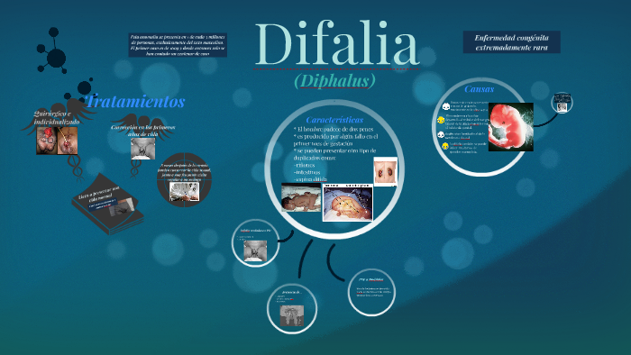 Difalia by Andrea Garcia on Prezi
