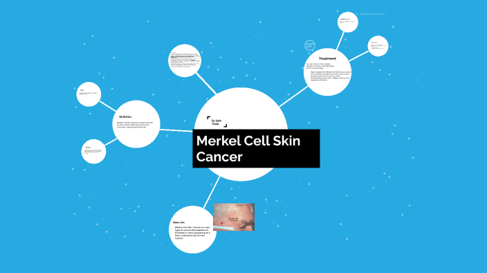 Merkel Cell Skin Cancer by seth traub on Prezi