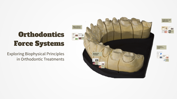 Orthodontics Force Systems by sfkwj fkffj on Prezi