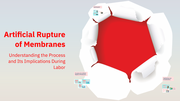 Artificial Rupture of Membranes by Savannah Gideon on Prezi