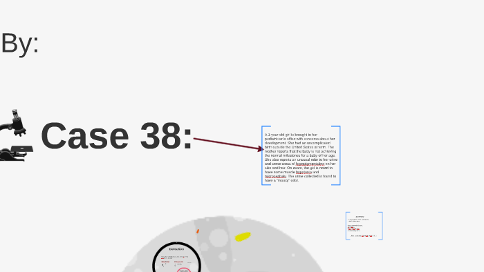 Case 38: by on Prezi