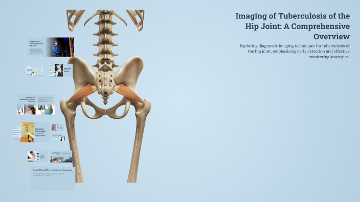 Imaging of Tuberculosis of the Hip Joint: A Comprehensive Overview by ...