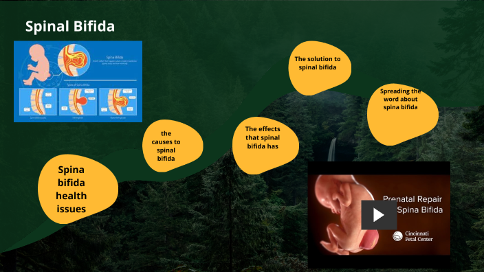 spinal bifida by Logan Hackett on Prezi